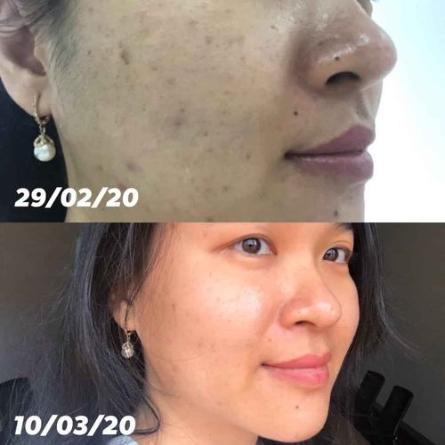 Niacid.co.uk Reviews - 14 Reviews | niacid.co.uk