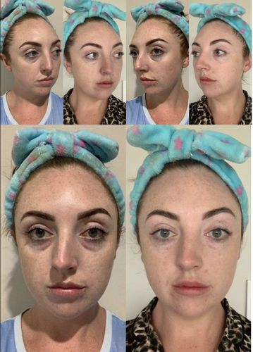 Permaderm Reviews - 168 Reviews | permaderm.co.nz