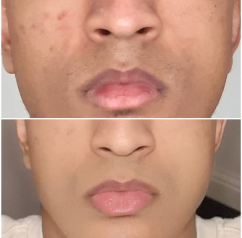 Earthly Derm Reviews - 2,959 Reviews | secure-the-candy.myshopify.com