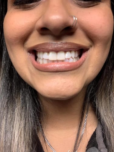 Smile Alive Avis - 684 Avis | smilealive.shop