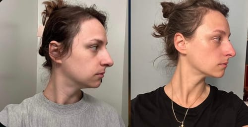 Luminique Reviews - 233 Reviews | luminiqueskin.com