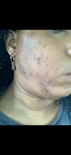 Earthly Derm Reviews - 2,734 Reviews | earthlyderm.com