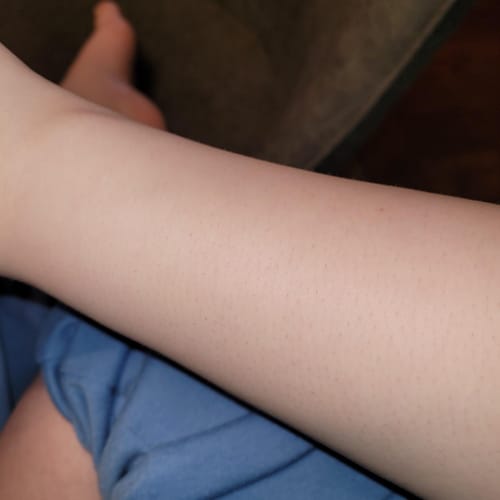 Dermave Reviews - 1,959 Reviews | dermave.co