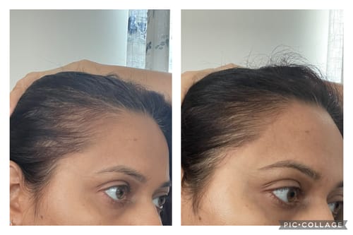 Growplex Reviews - 899 Reviews | growplex.co